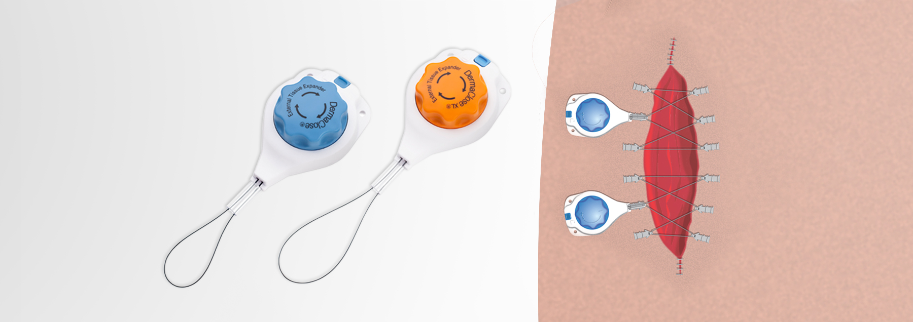 TapMed Medizintechnik – innovative Medizinprodukte